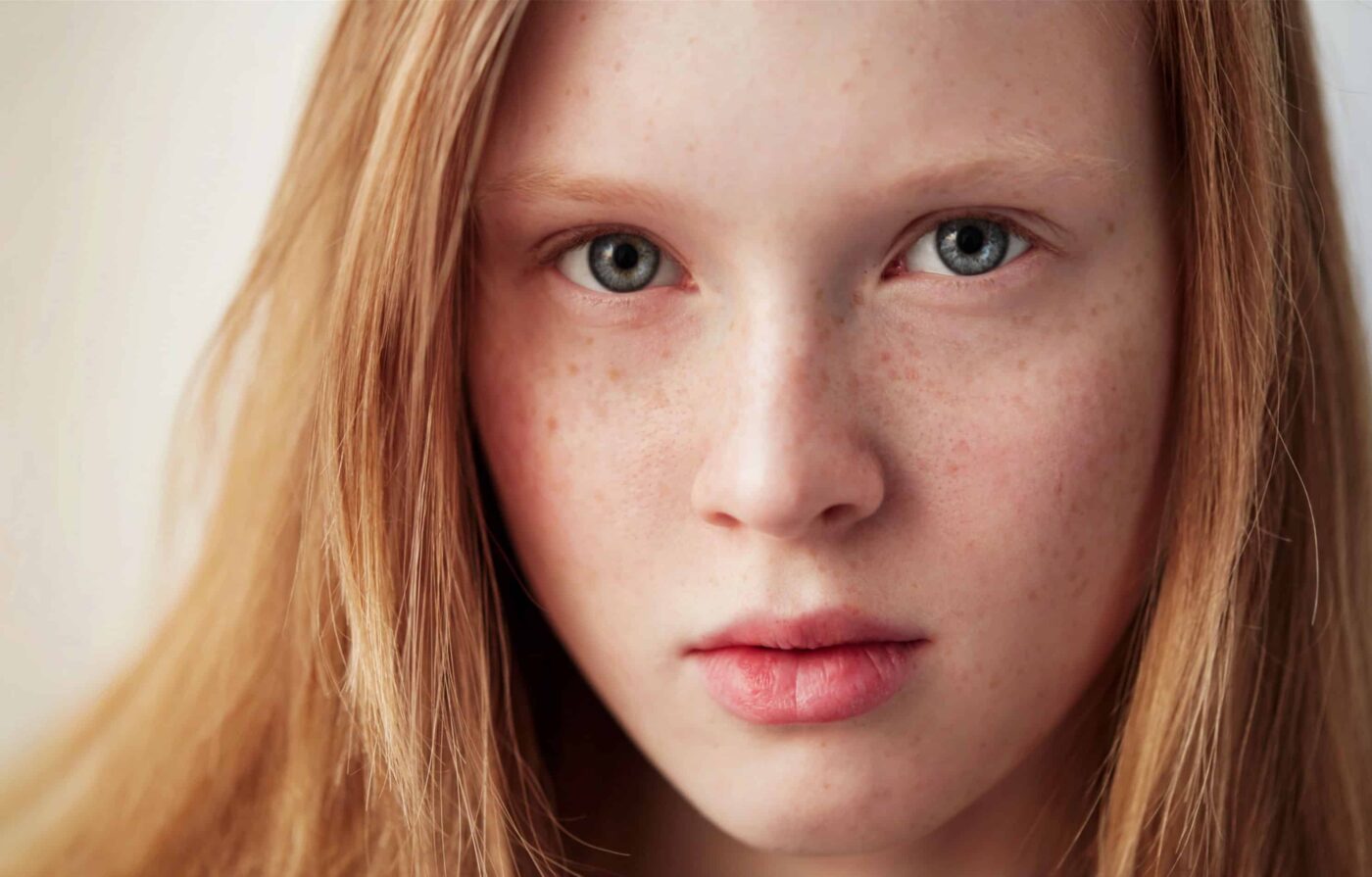 How to Enhance Freckles and Add a Dim Moody Look in Photoshop | Denny's ...